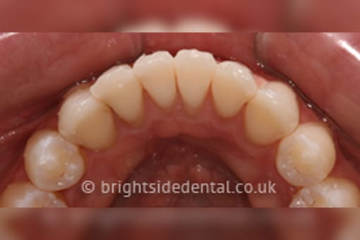 Dental Smile Gallery | Brightside Dental