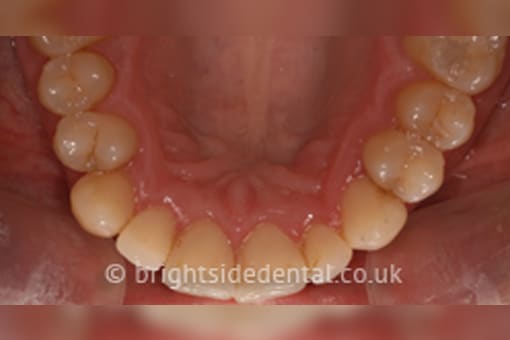 Dental Smile Gallery | Brightside Dental