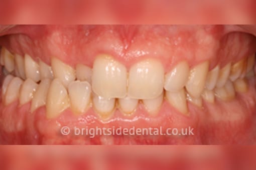 Dental Smile Gallery | Brightside Dental