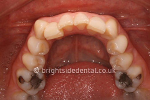 Dental Smile Gallery | Brightside Dental