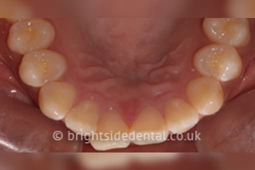 Dental Smile Gallery | Brightside Dental