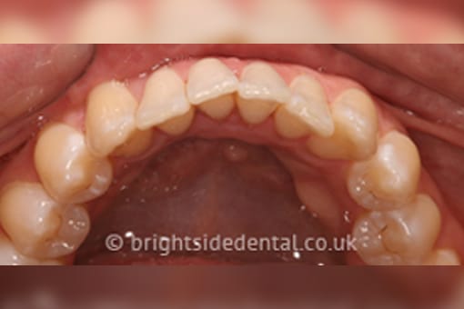 Dental Smile Gallery | Brightside Dental