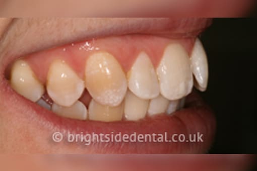 Dental Smile Gallery | Brightside Dental